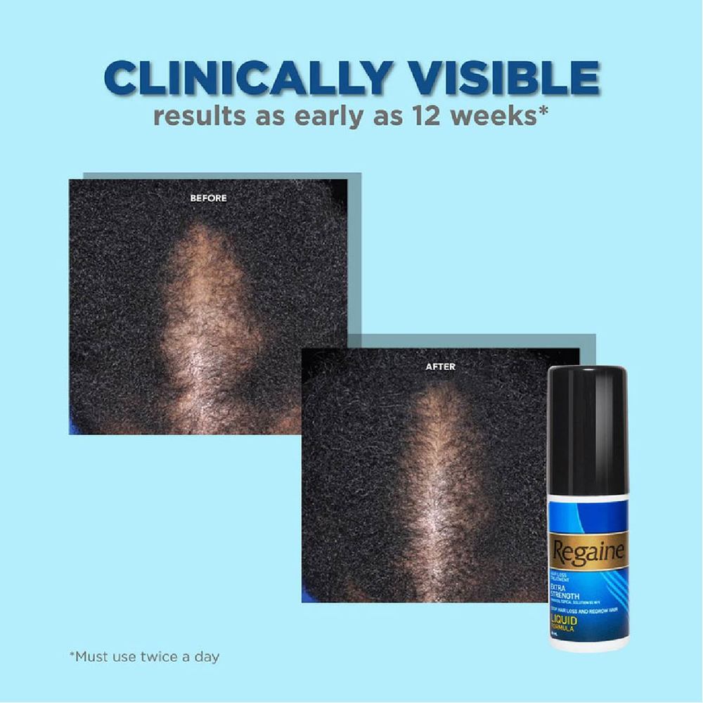Regaine Extra Strength Minoxidil Topical Solution 5 W V Solution For